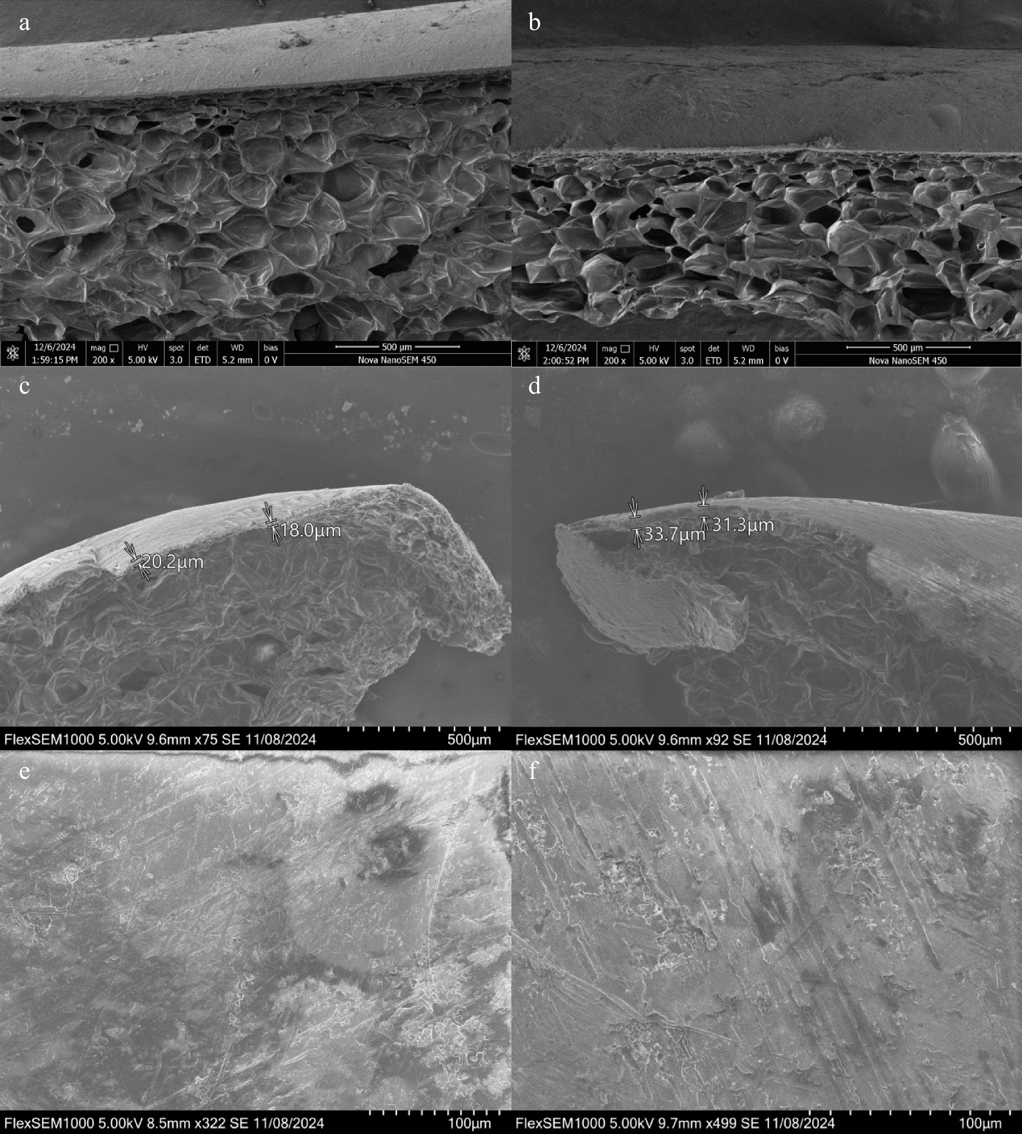Physiological and molecular insights into peel thickness variation ...