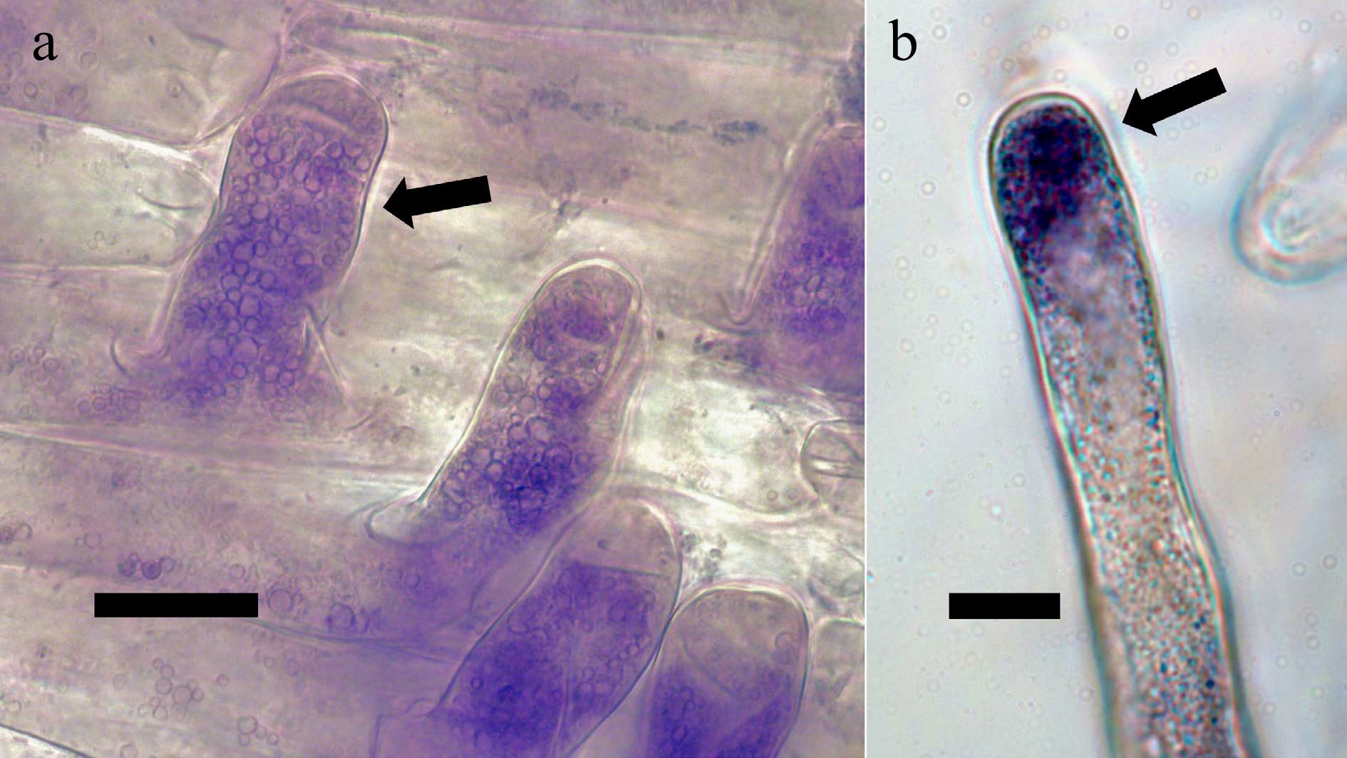 Endophyte symbiosis evolutionary development, and impacts of plant ...