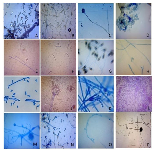 A study of commonly occurring fungal diseases on stored tomatoes of ...