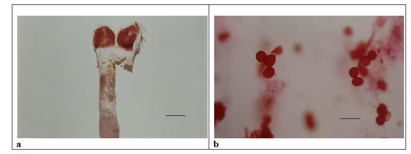 Diversity of Gasteromycetes in Rajasthan, India-I