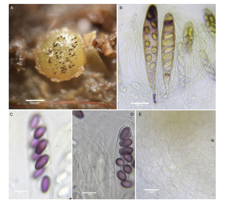 Contributions to the family Ascobolaceae of India