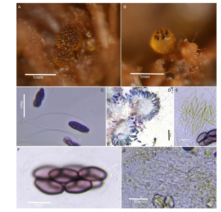 Contributions to the family Ascobolaceae of India