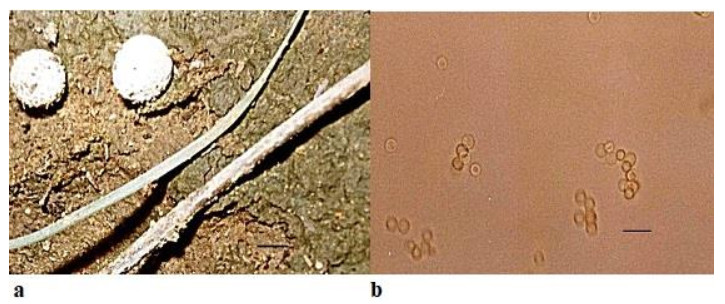 Diversity of Gasteromycetes in Rajasthan, India-Ⅱ