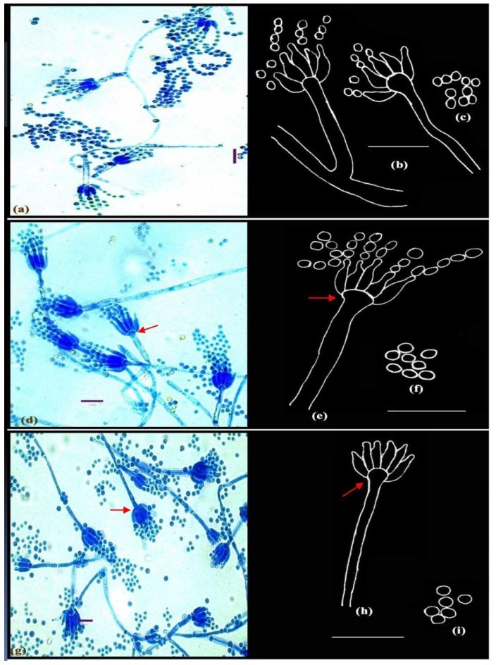 Penicillium Conidia 400x