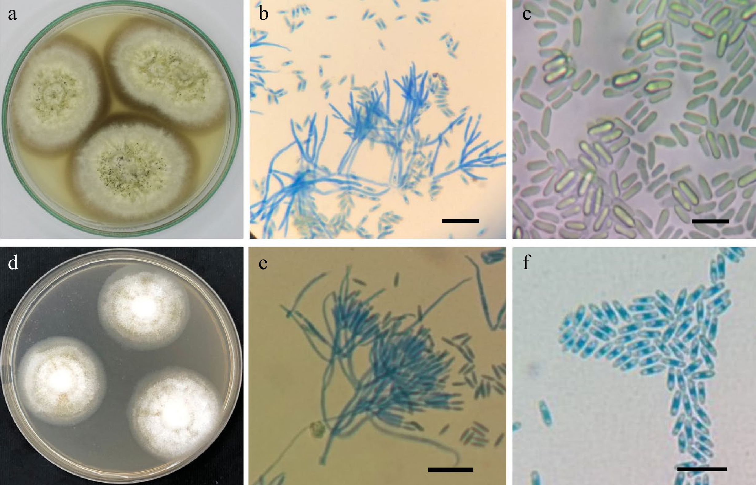 Contribution to the soil-based Egyptian mycobiota in Hypocreales ...