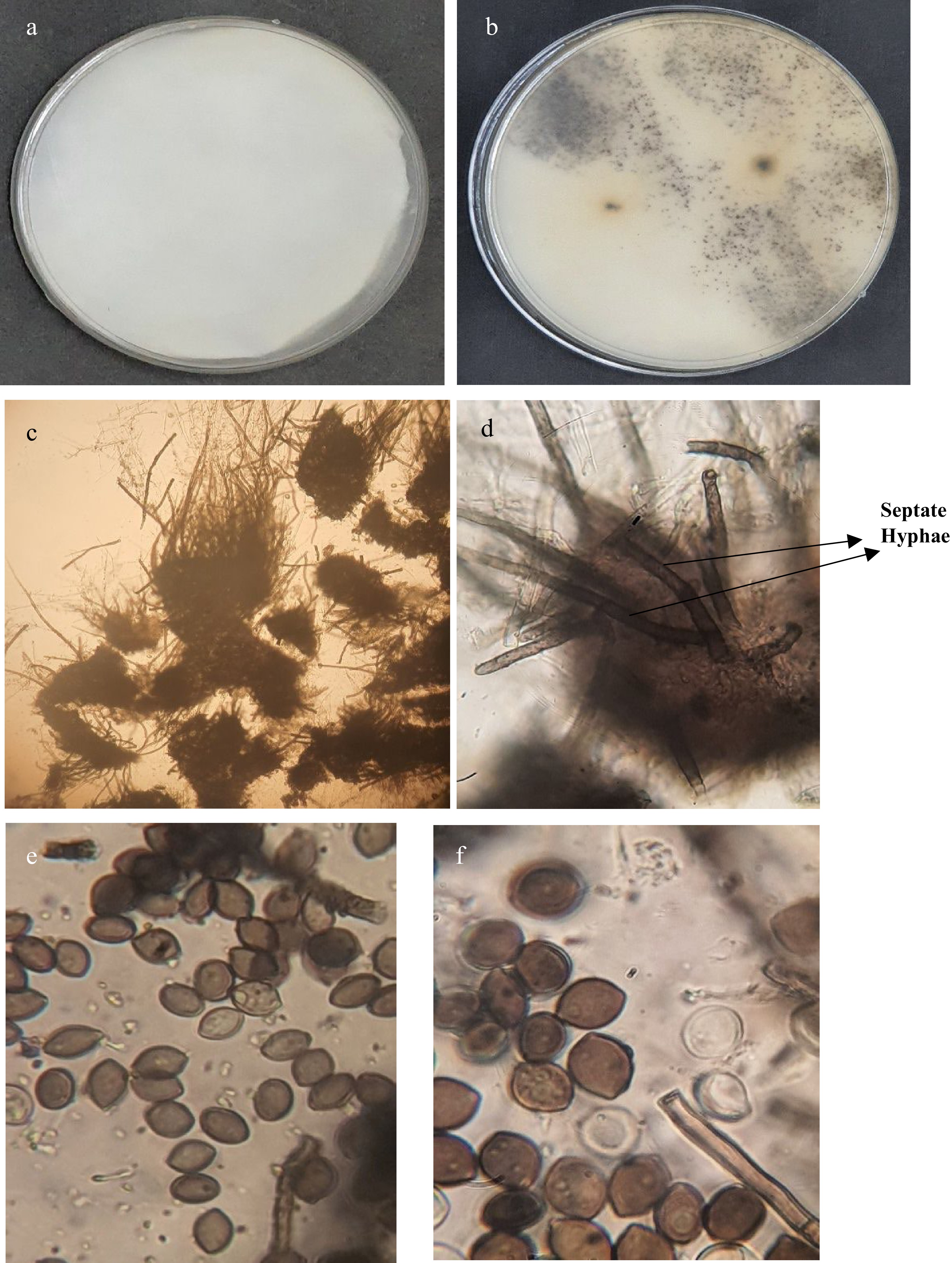 First record of Lepidoderma carestianum and Arthrinium bambusicola from ...