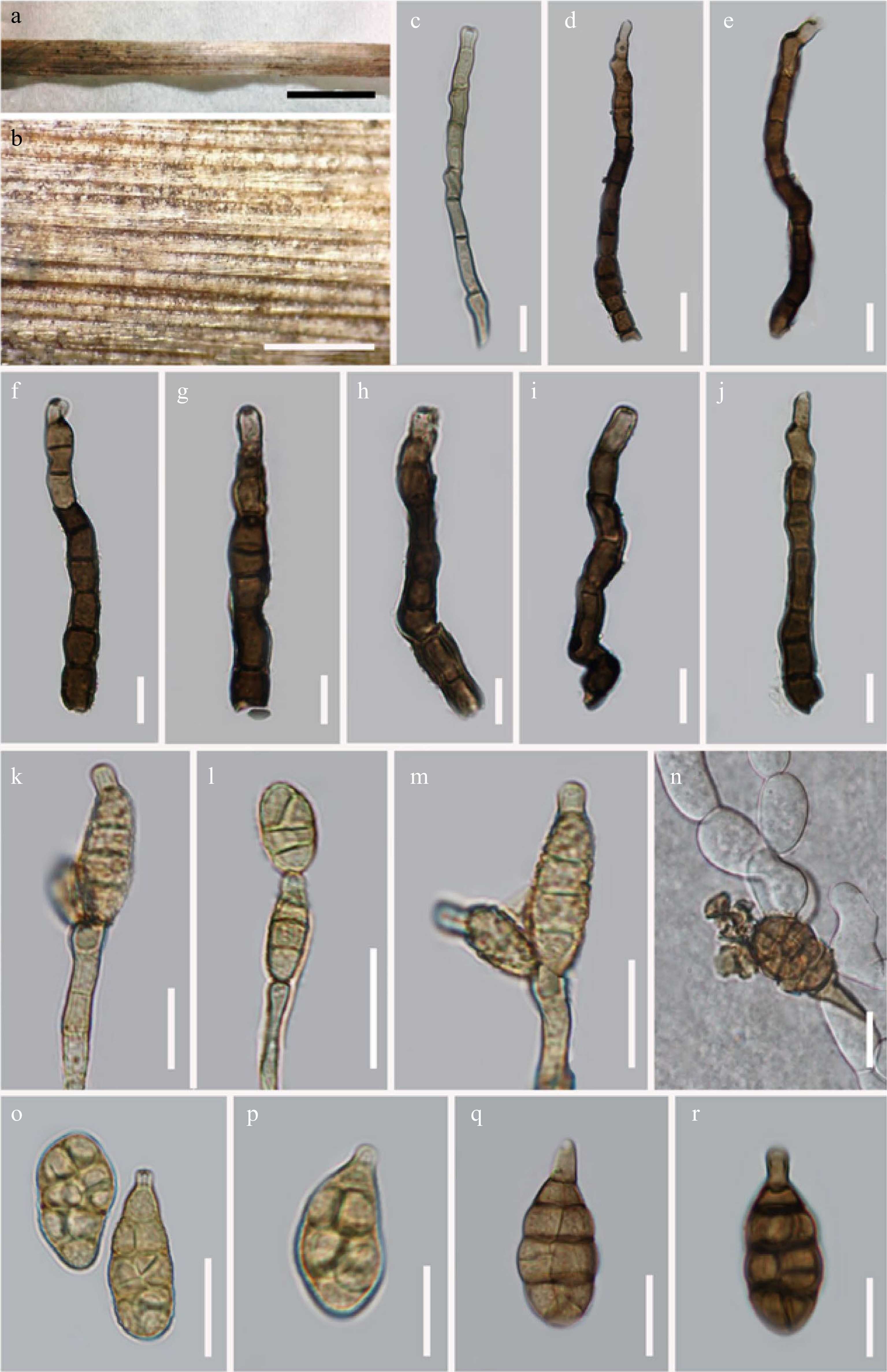 Colonia De Alternaria Alternaria Update On Species Limits, Evolution,