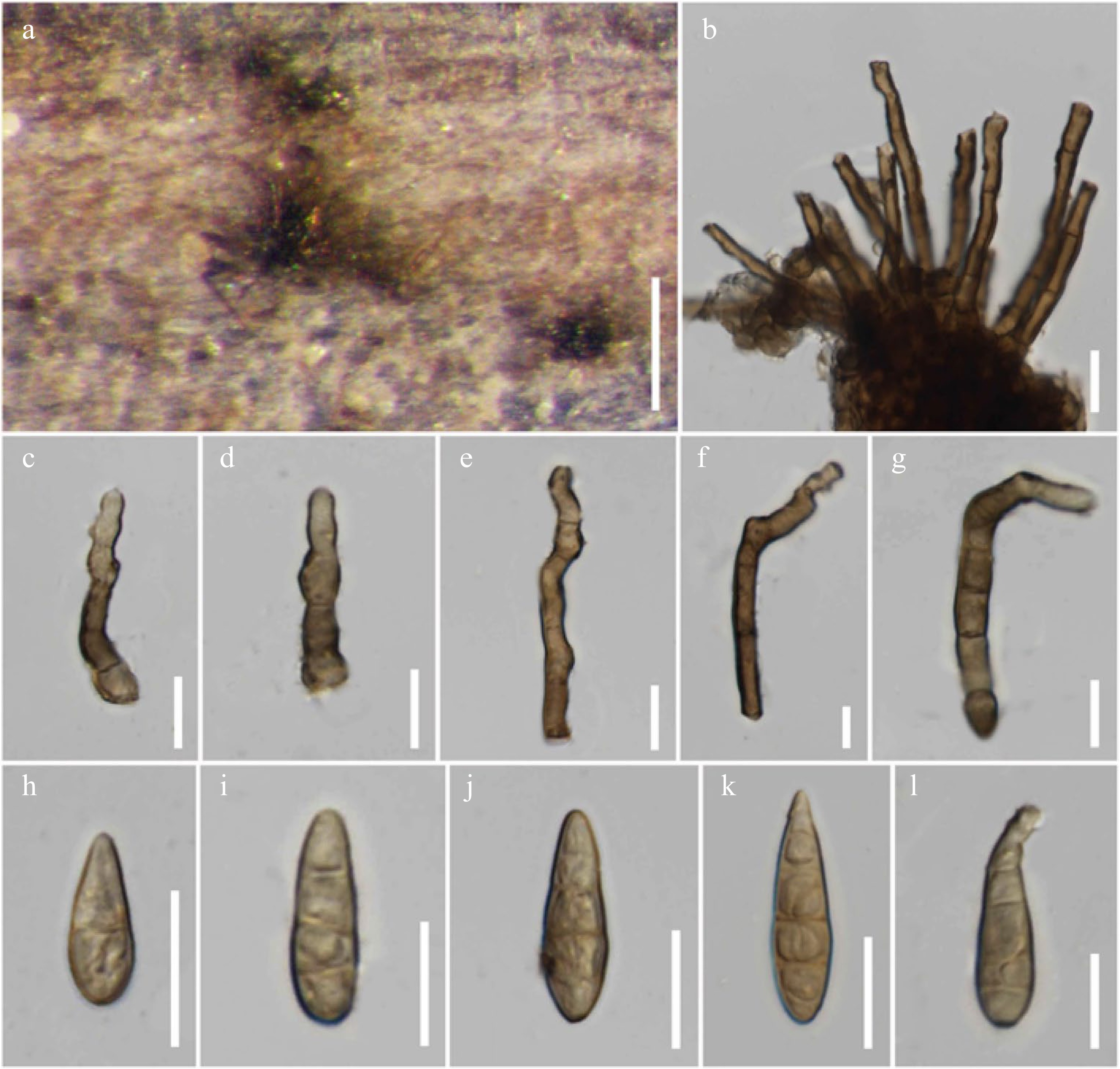 Alternaria : update on species limits, evolution, multi-locus phylogeny ...