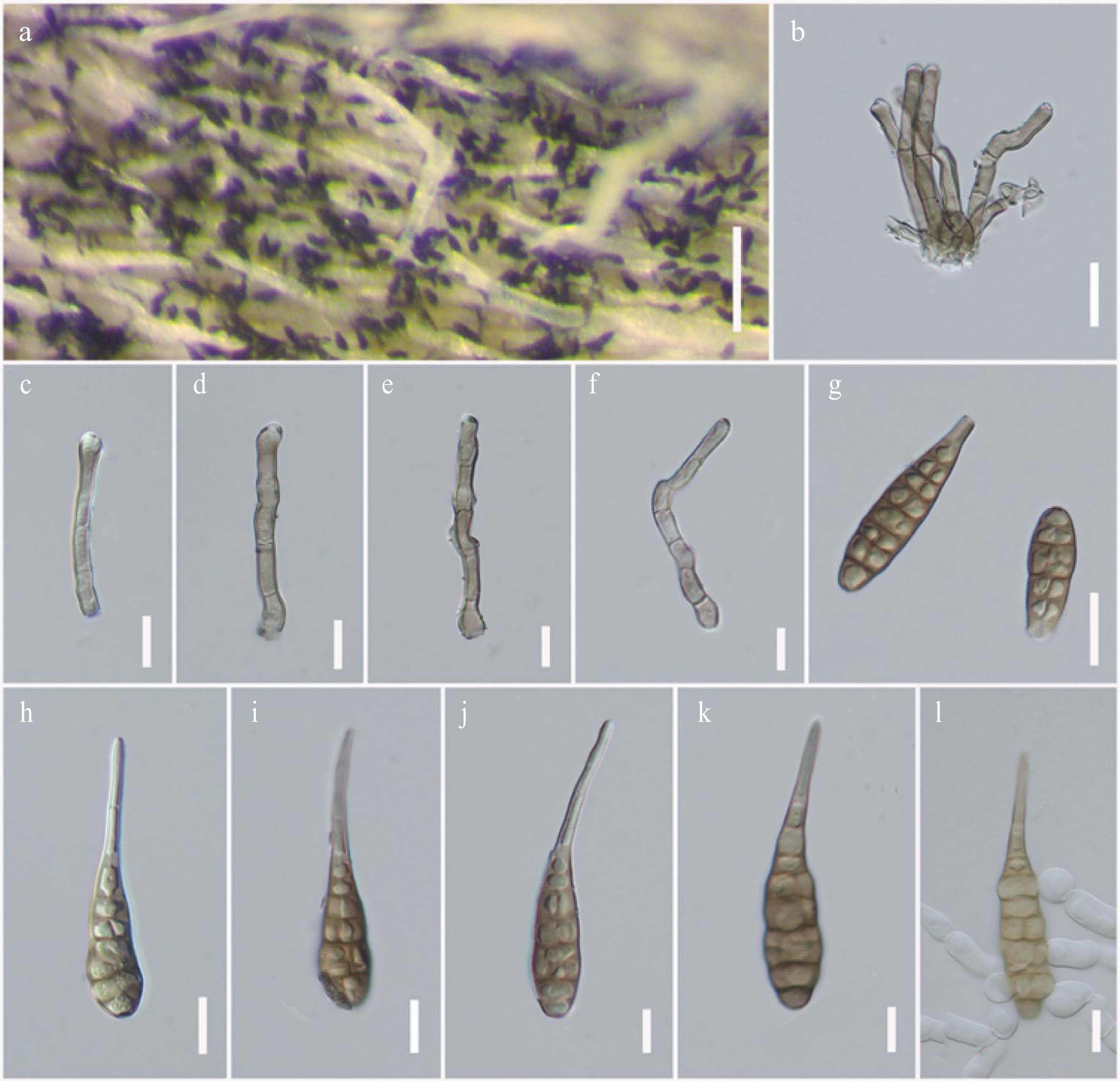 Alternaria update on species limits, evolution, multi-locus phylogeny ...