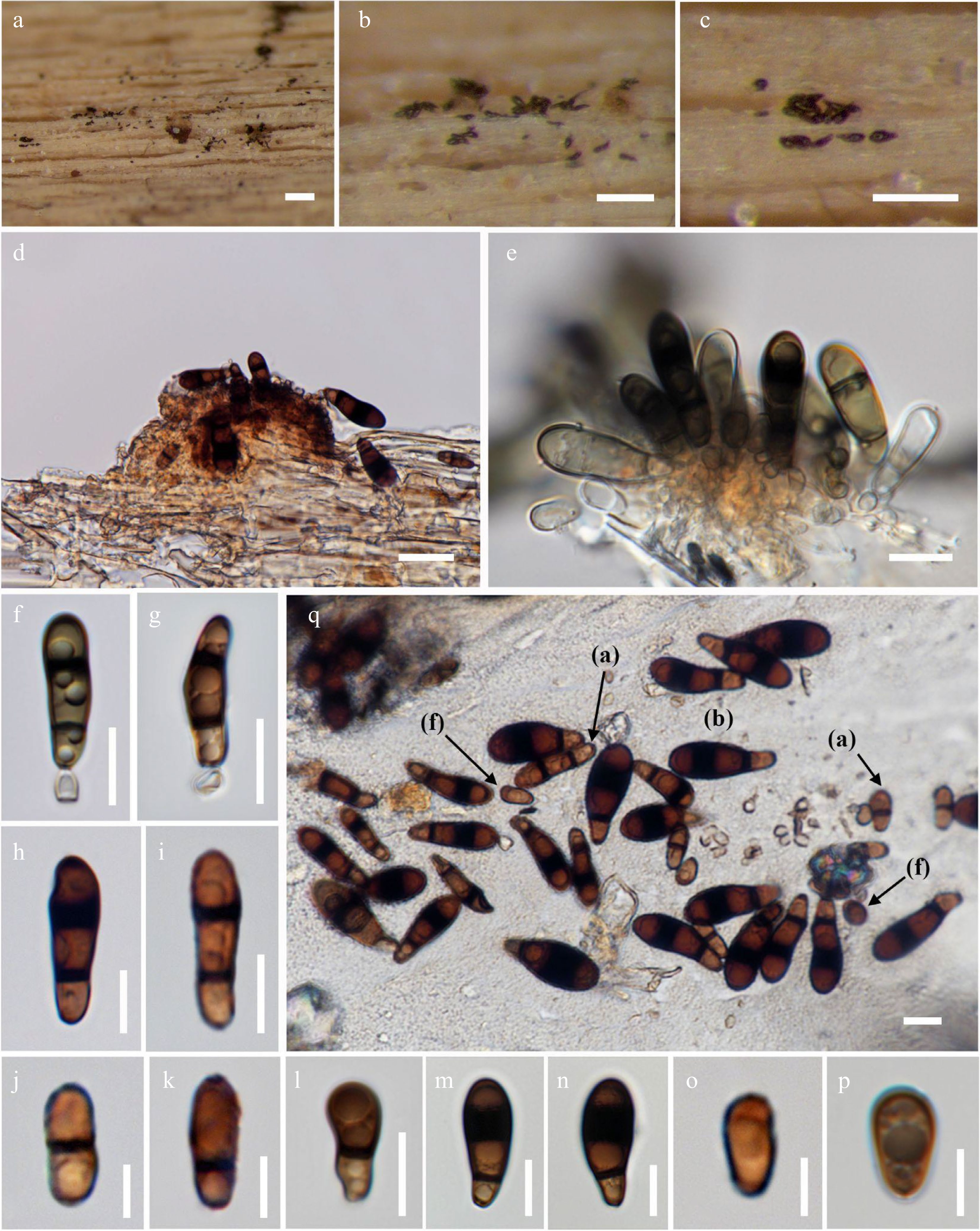 Addition to Microascales (Sordariomycetes, Ascomycota ...