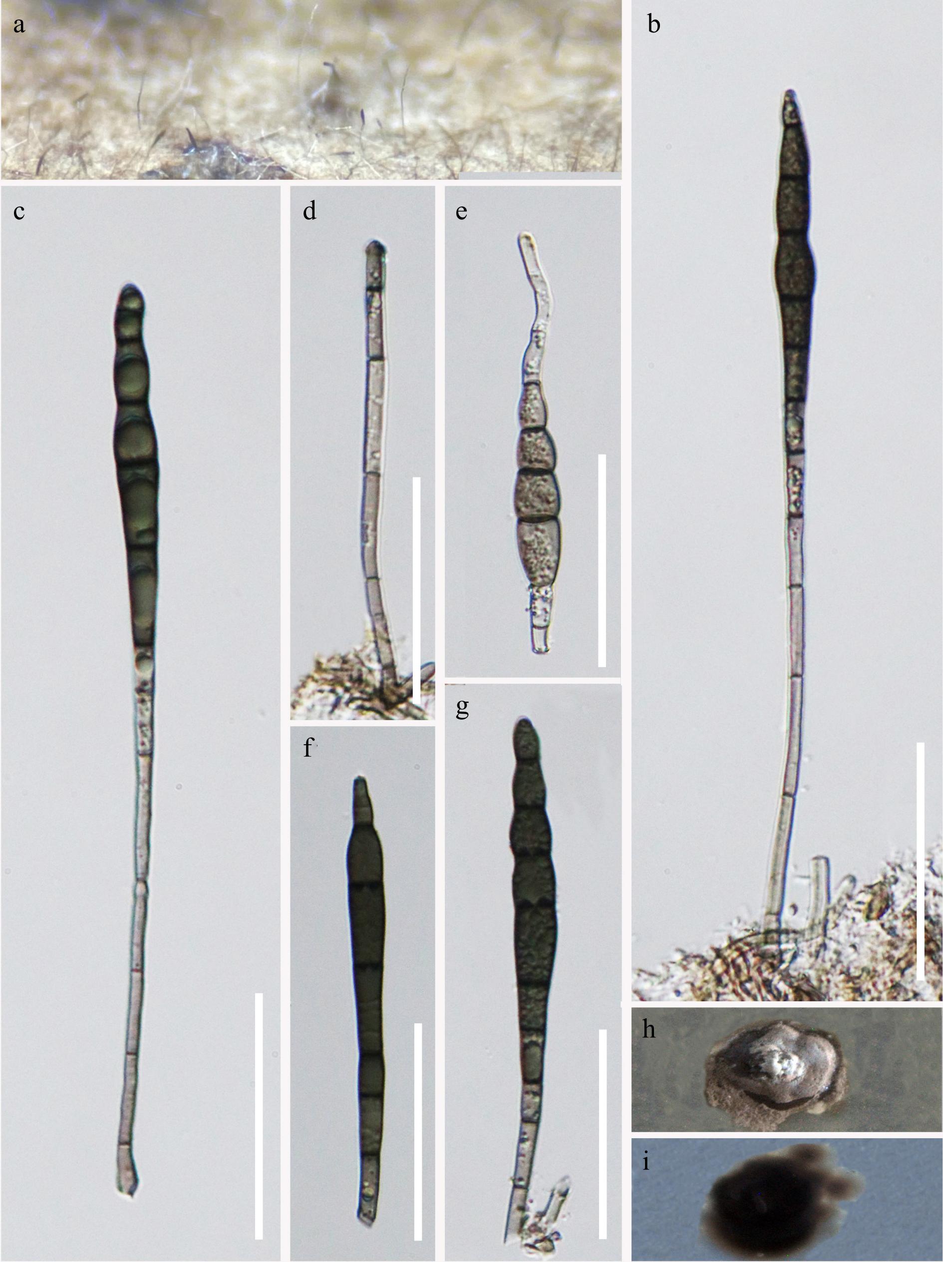 Savoryella claviformis ( Savoryellaceae ), a new freshwater ...