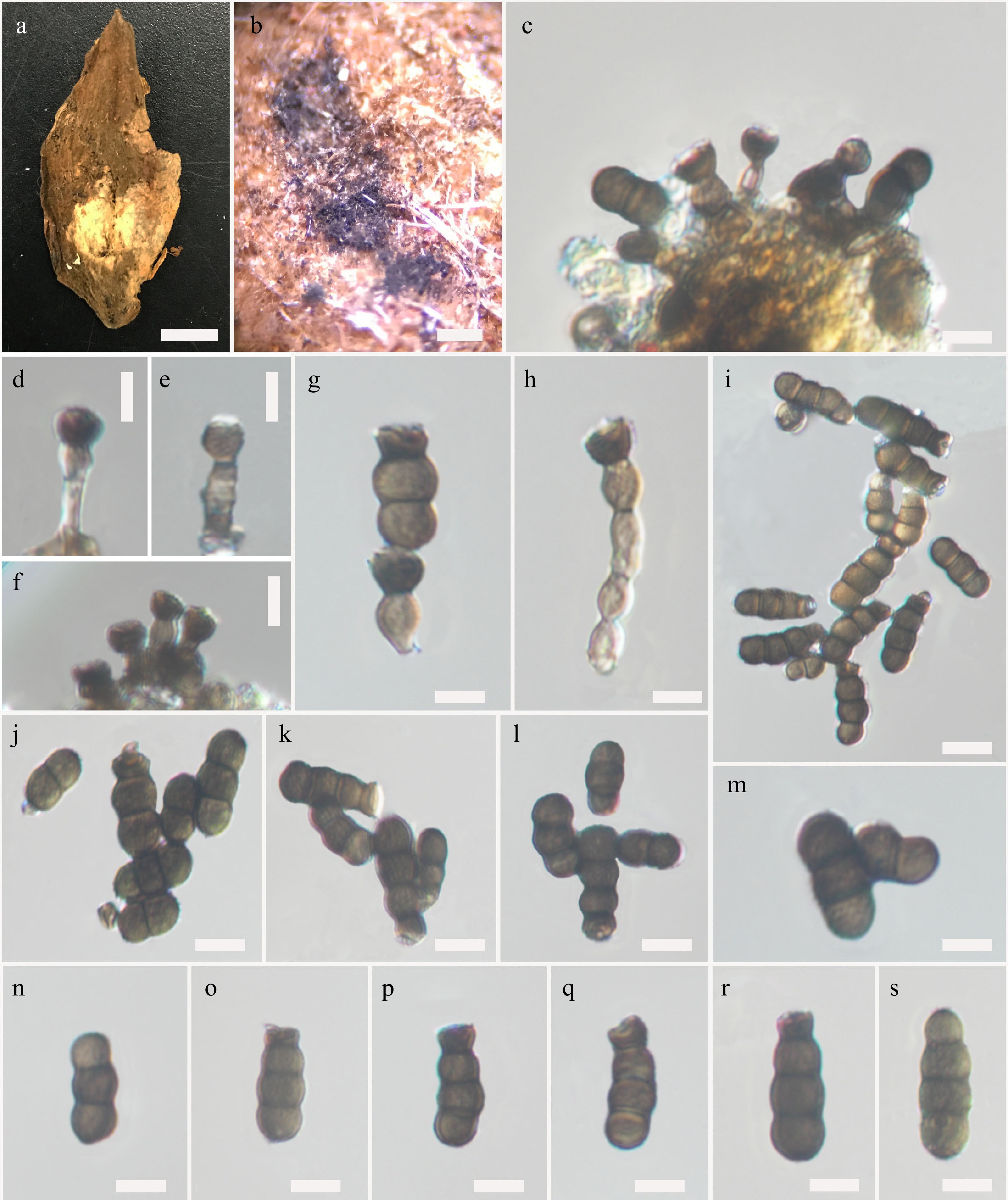 Torula aquilariae sp. nov. (Torulaceae, Pleosporales), a new species ...