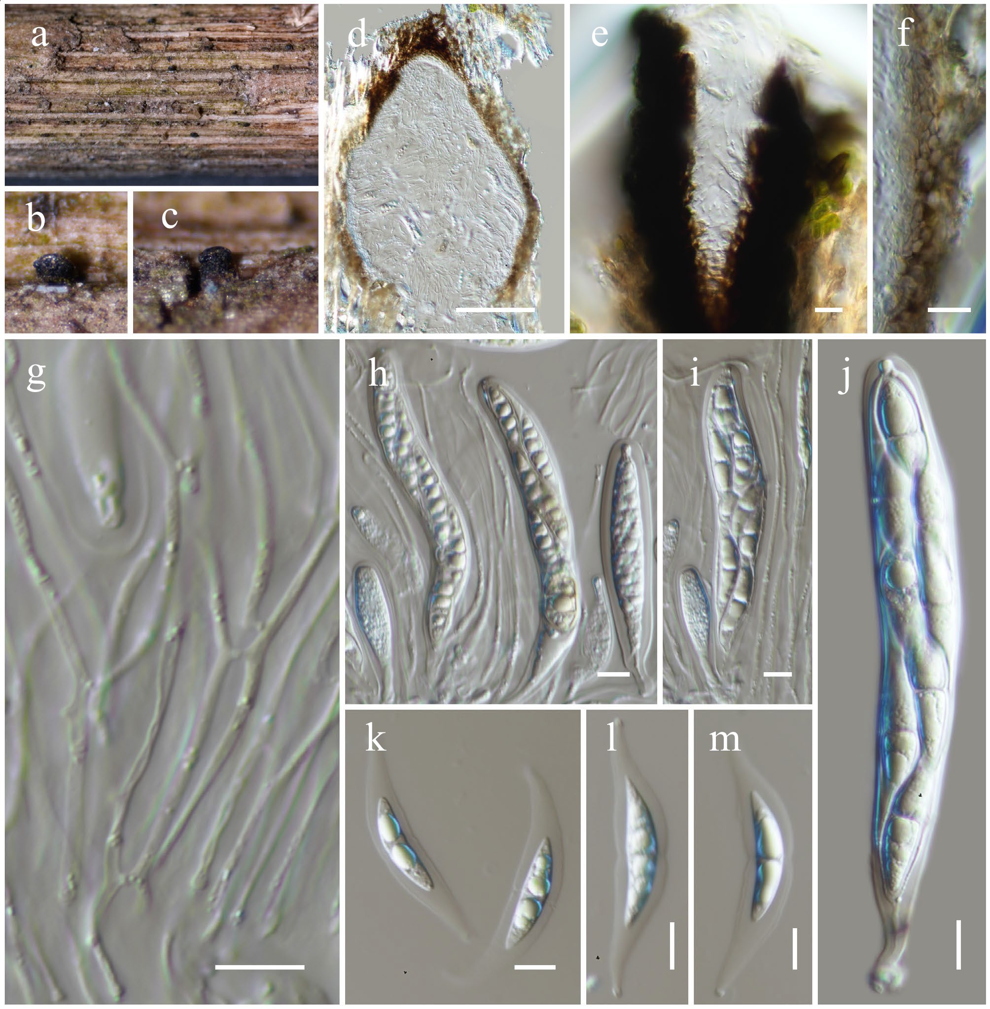 Unexplored microfungal diversity from dead woody litter in the dry-hot ...
