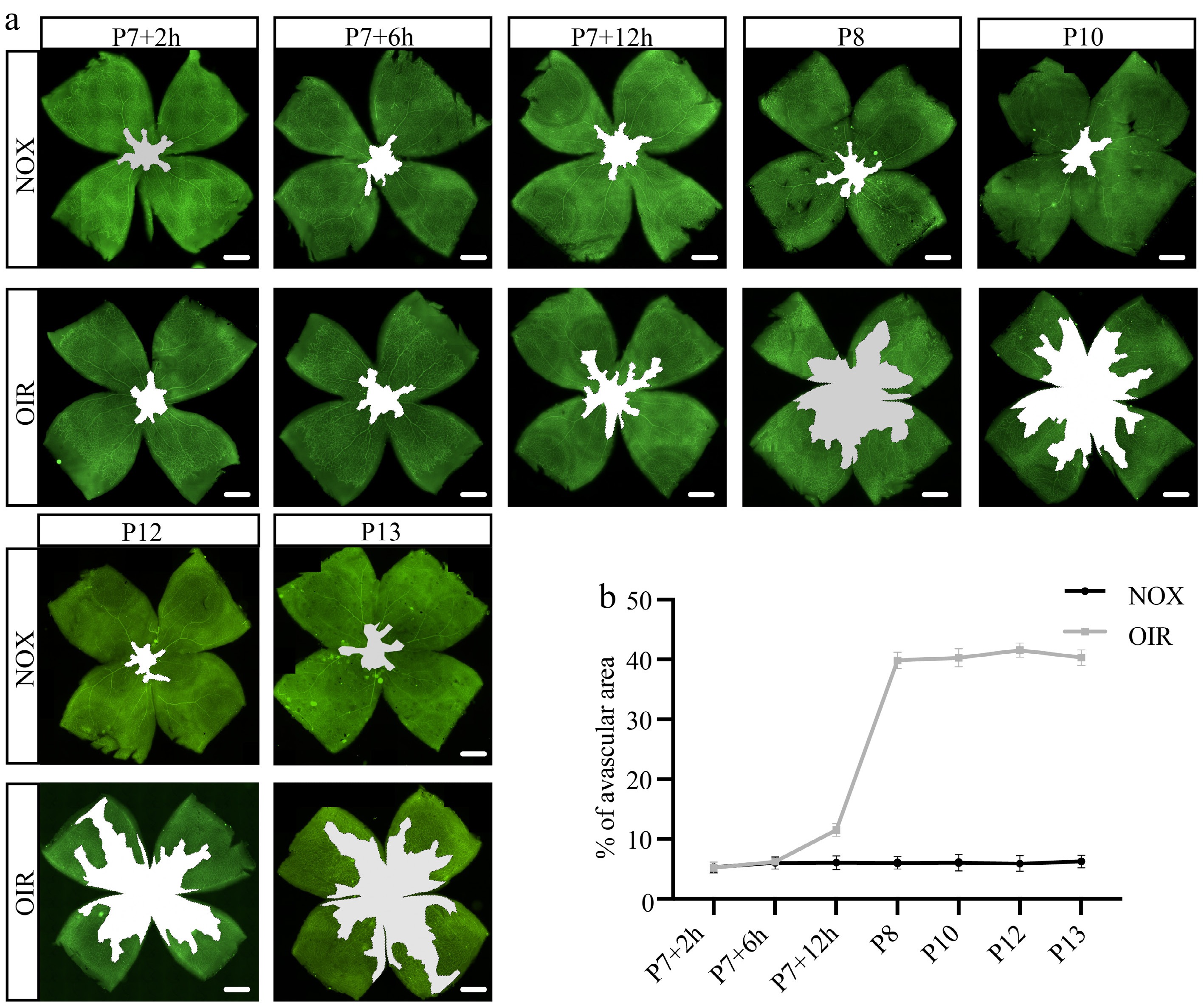 Microglial phagocytosis involves hyperoxia-induced vessel regression in ...