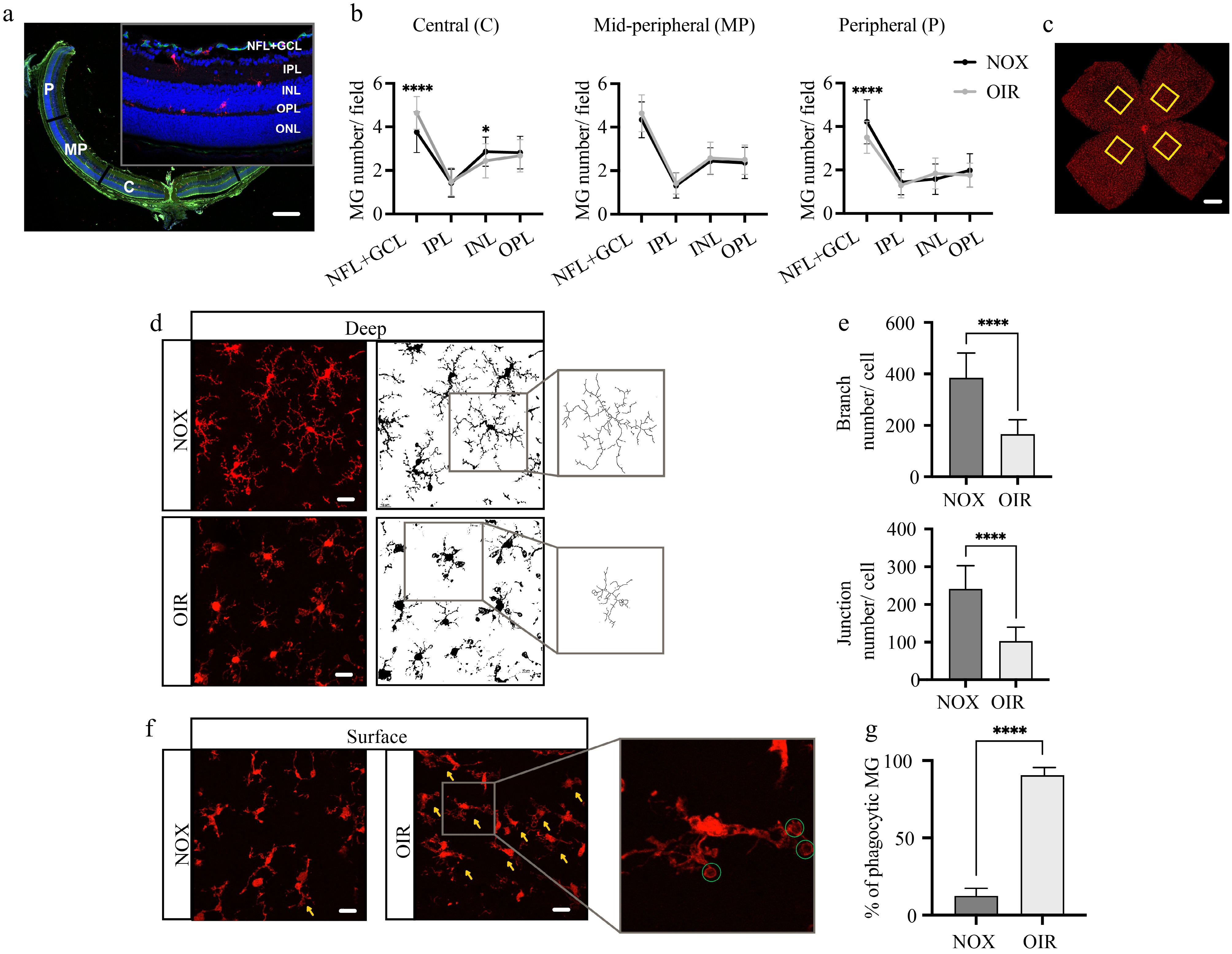 Microglial phagocytosis involves hyperoxia-induced vessel regression in ...