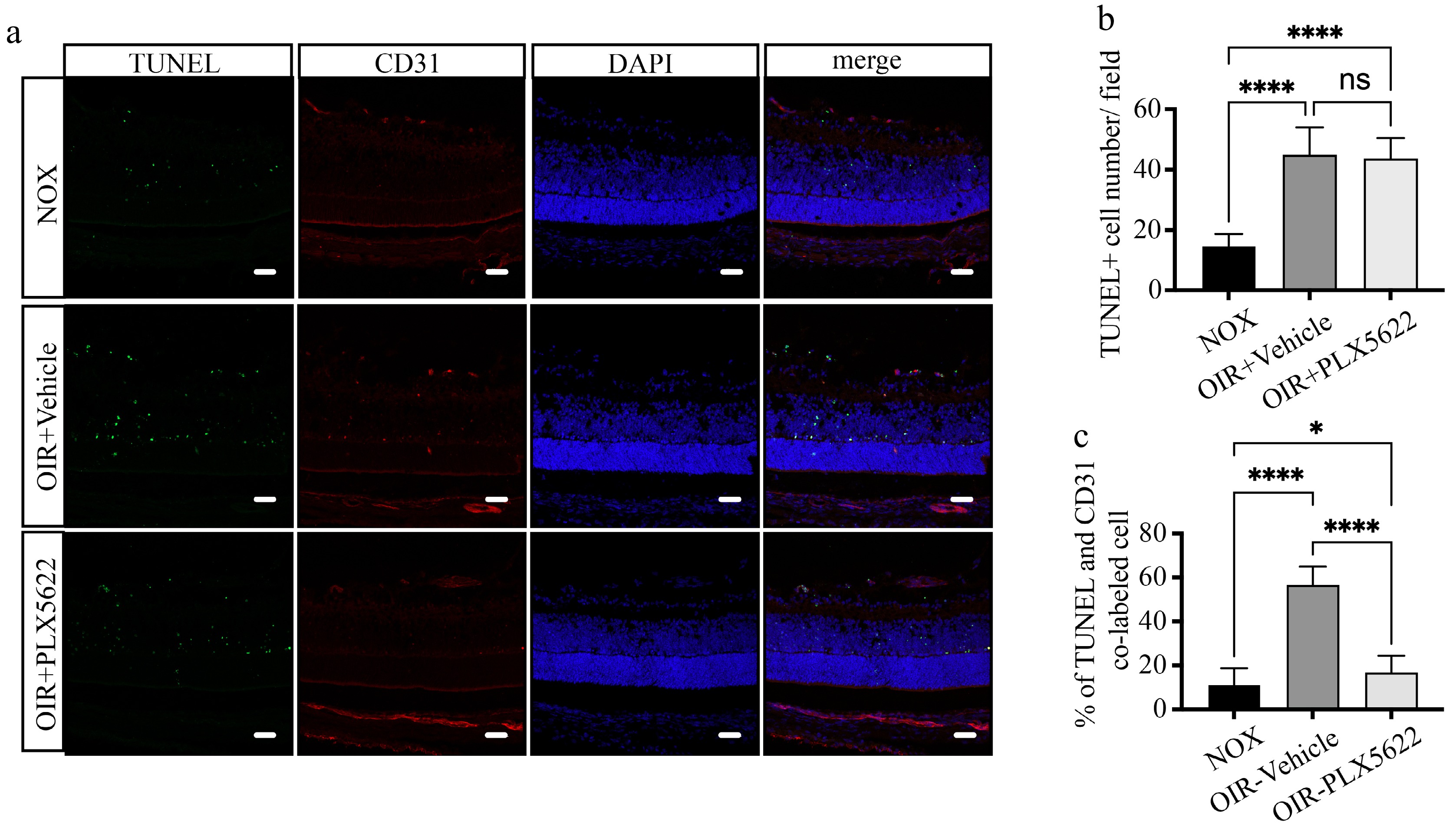 Microglial phagocytosis involves hyperoxia-induced vessel regression in ...
