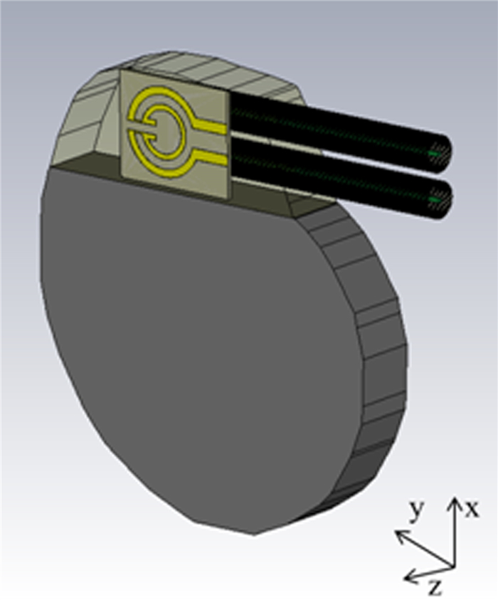 Inductive link for power and data transfer to a medical implant