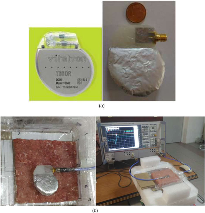 Inductive link for power and data transfer to a medical implant