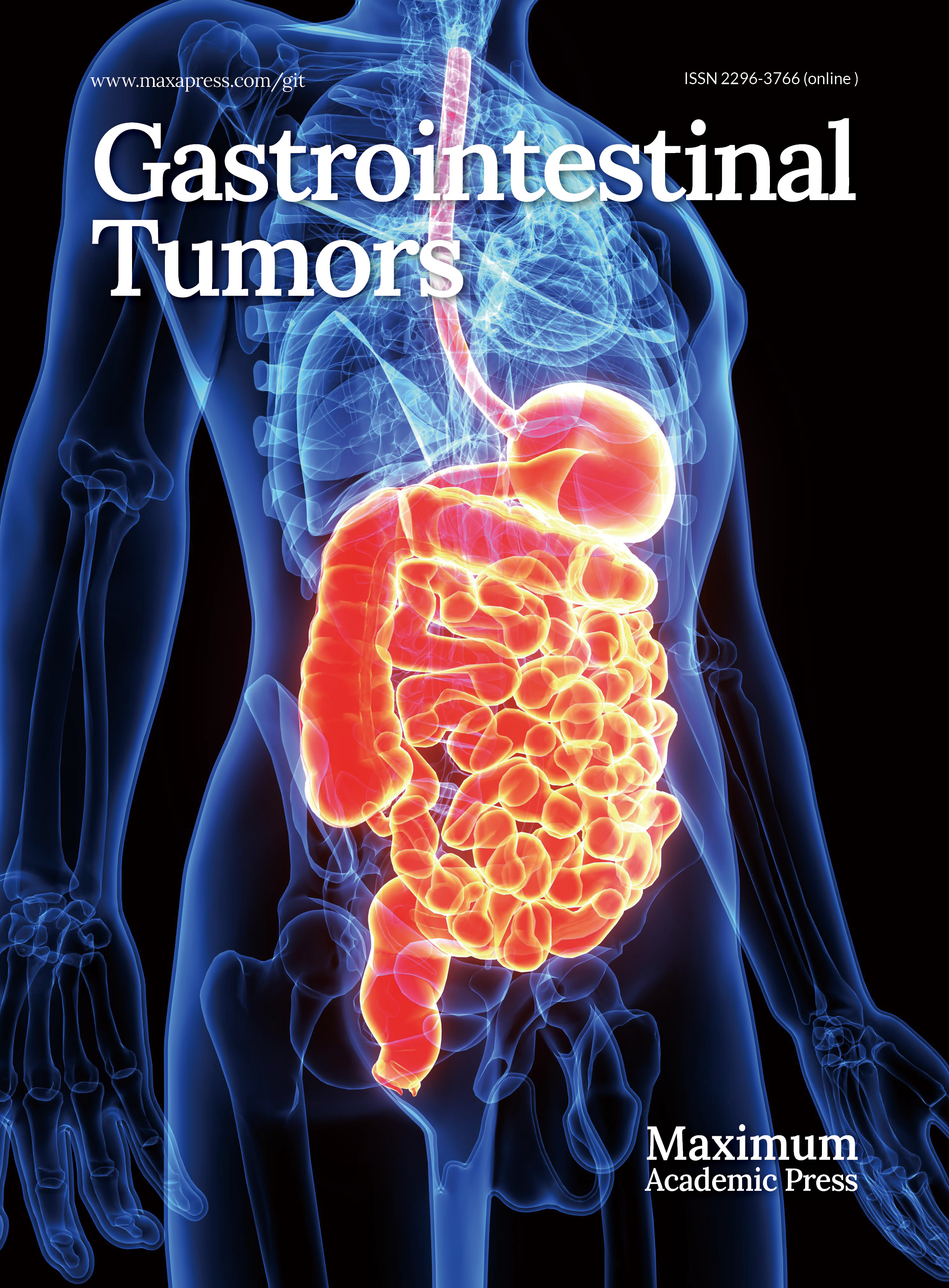 Gastrointestinal Tumors